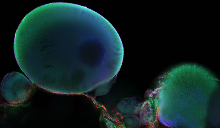 Gygi Lab develops methods to identify and quantify thousands of ...